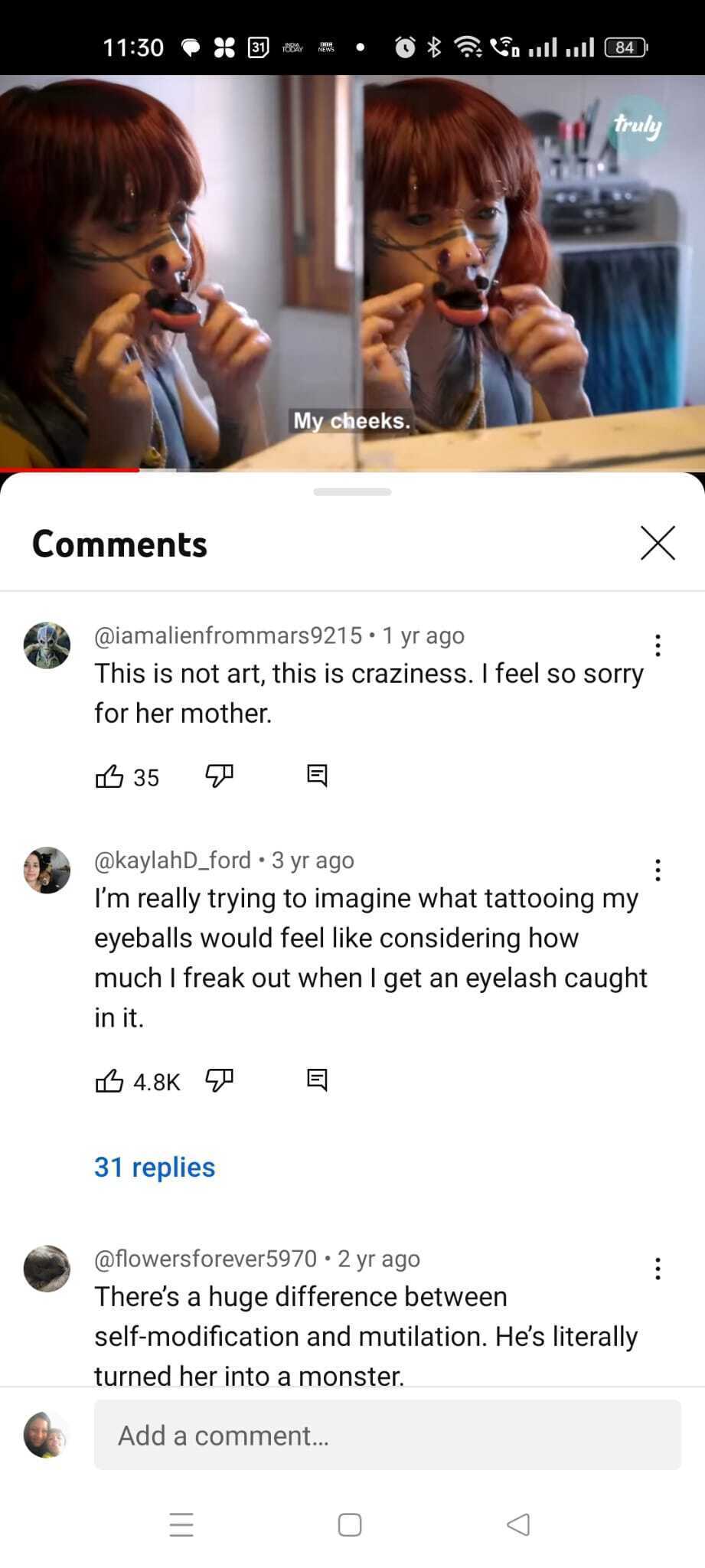 Sokkoló képek egy olasz nőről, aki teljesen elcsúfította magát